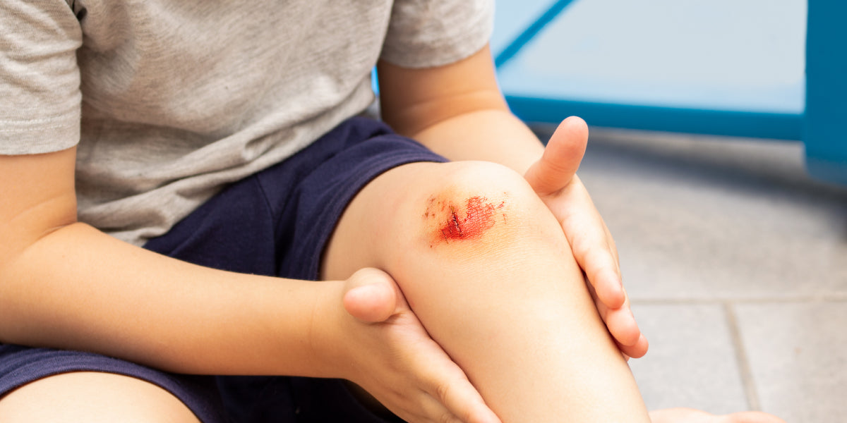 How to Treat Scrapes, Help Skin Heal | First Aid Spray | Dermoplast®